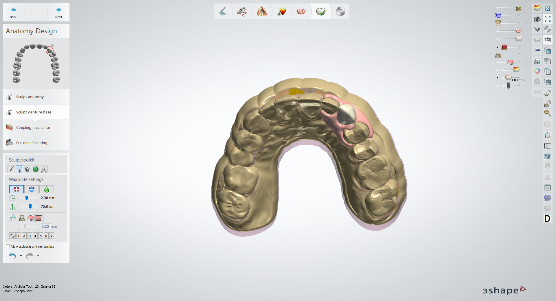 Workflow Guide: 3D Printing Flexible Dentures with HeyGears UltraCraft ...