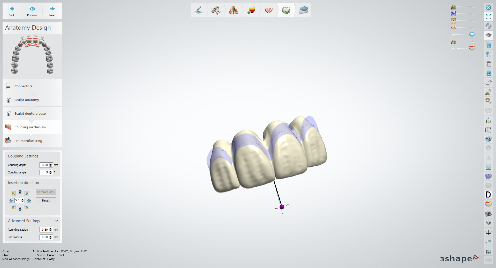 Workflow Guide: 3D Printing Flexible Dentures with HeyGears UltraCraft ...
