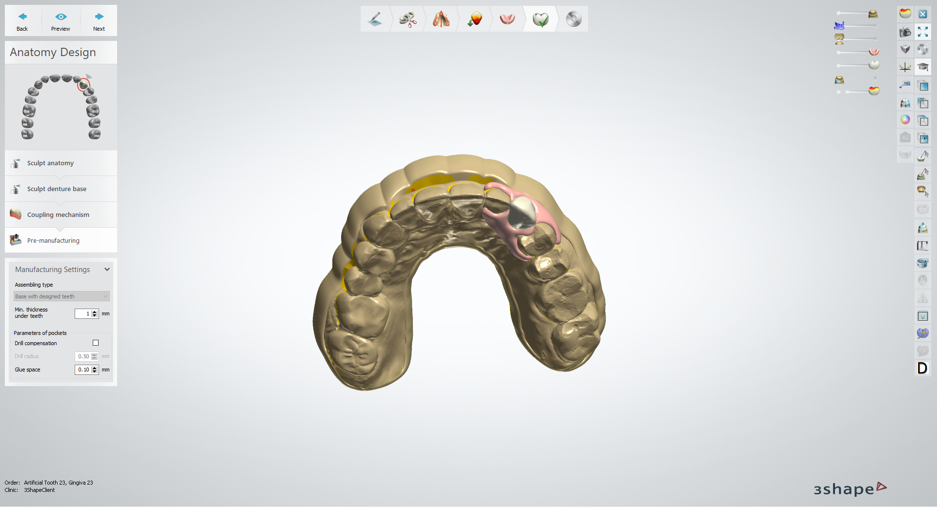 Workflow Guide: 3D Printing Flexible Dentures with HeyGears UltraCraft ...