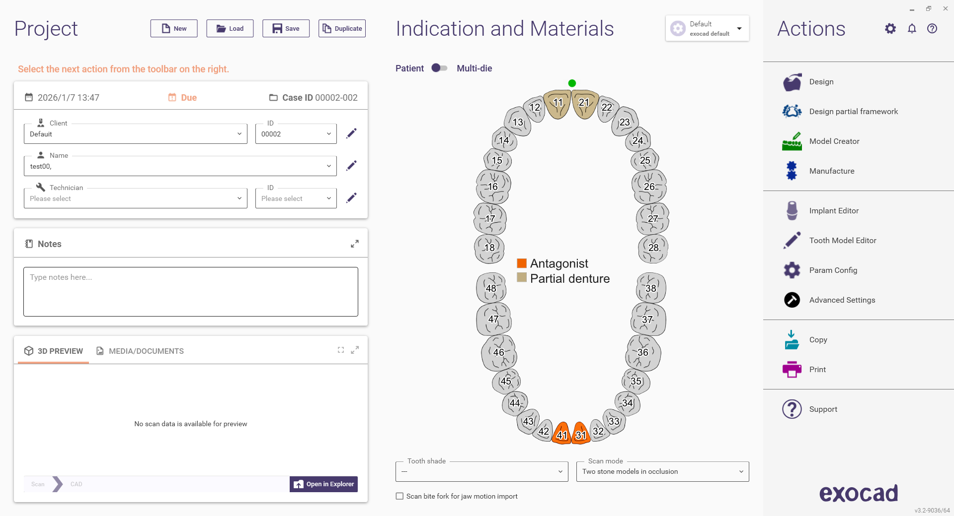 Workflow Guide: 3D Printing Flexible Dentures with HeyGears UltraCraft ...