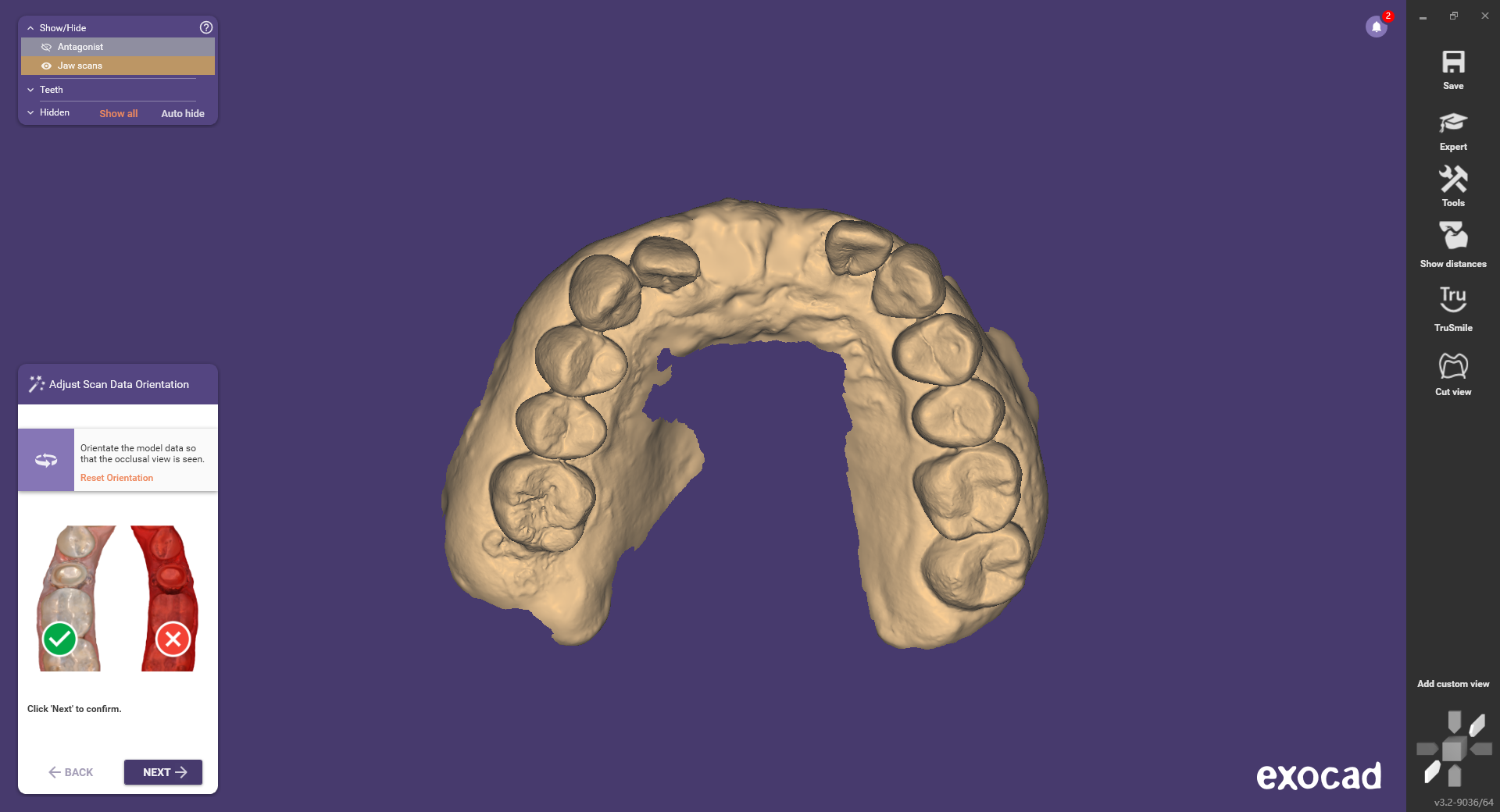 Workflow Guide: 3D Printing Flexible Dentures with HeyGears UltraCraft ...