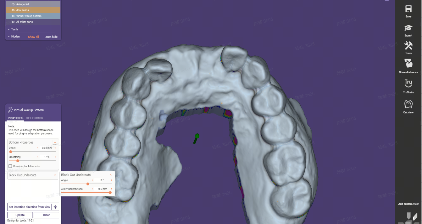 Workflow Guide: 3D Printing Flexible Dentures with HeyGears UltraCraft ...