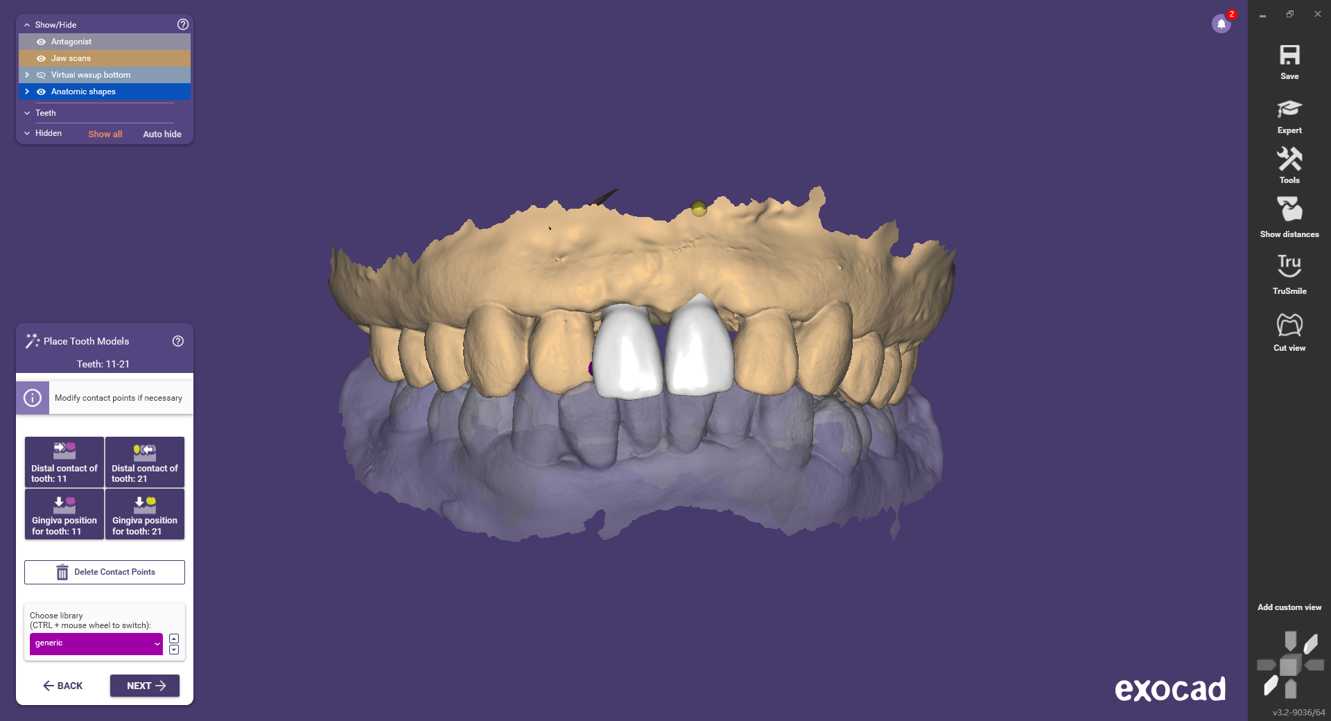Workflow Guide: 3D Printing Flexible Dentures with HeyGears UltraCraft ...