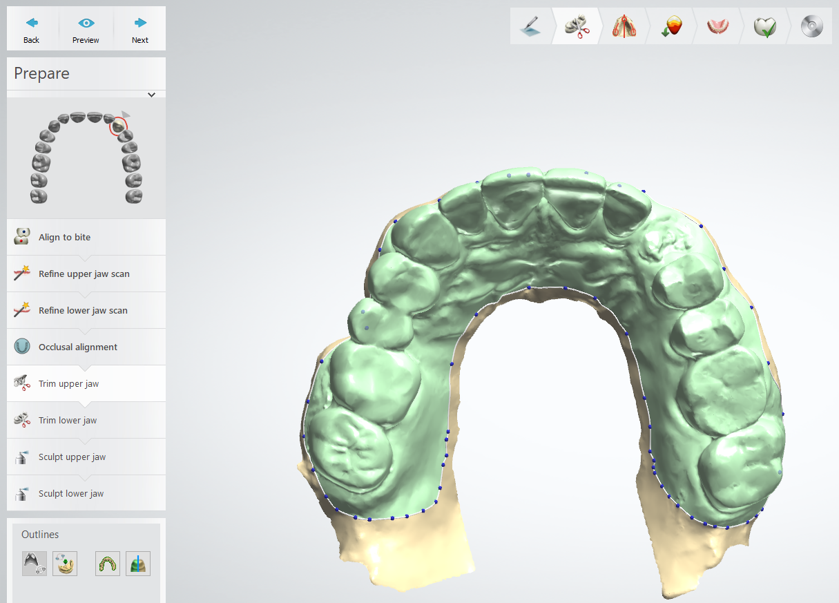 Workflow Guide: 3D Printing Flexible Dentures with HeyGears UltraCraft ...