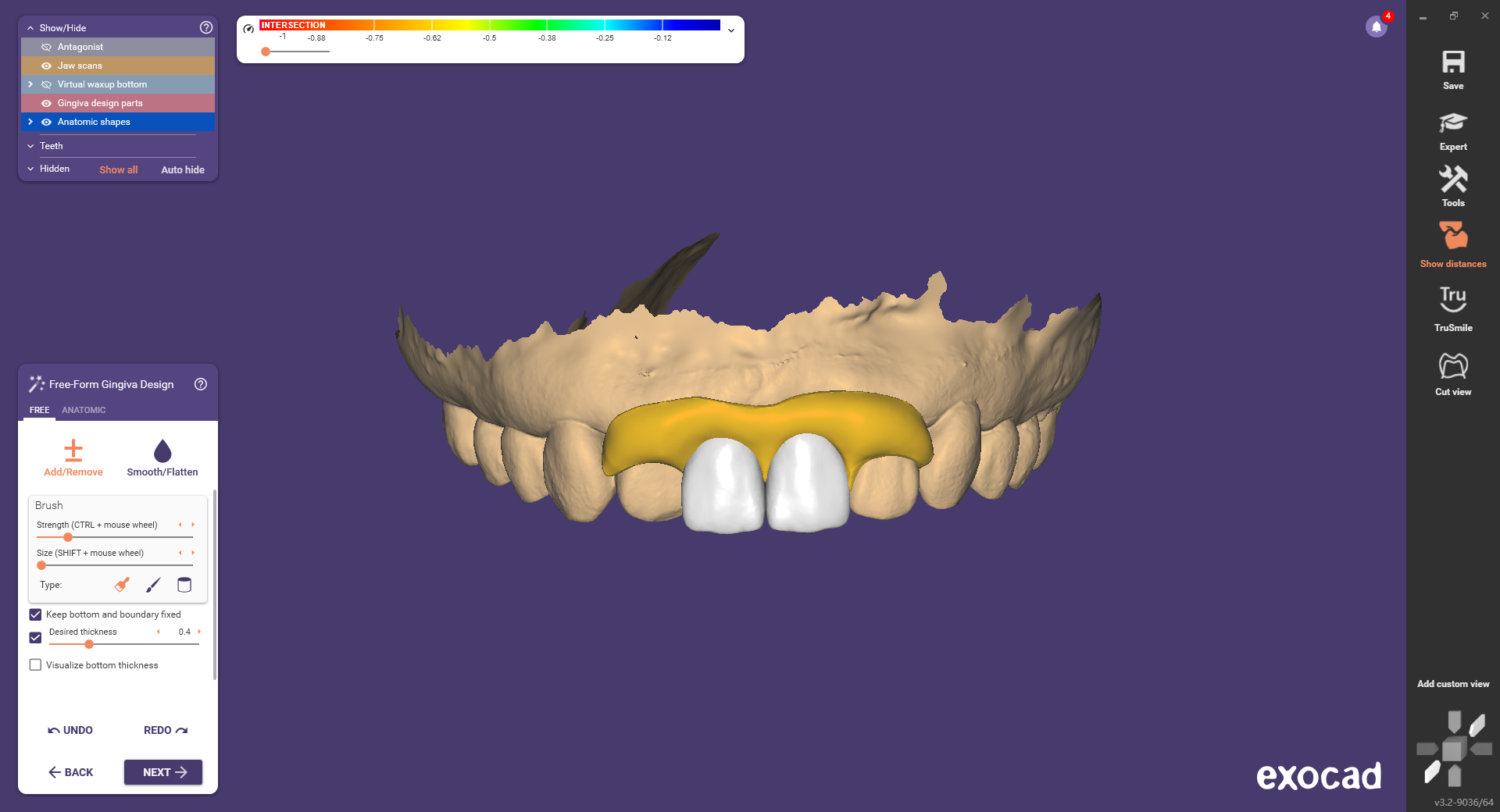 Workflow Guide: 3D Printing Flexible Dentures with HeyGears UltraCraft ...