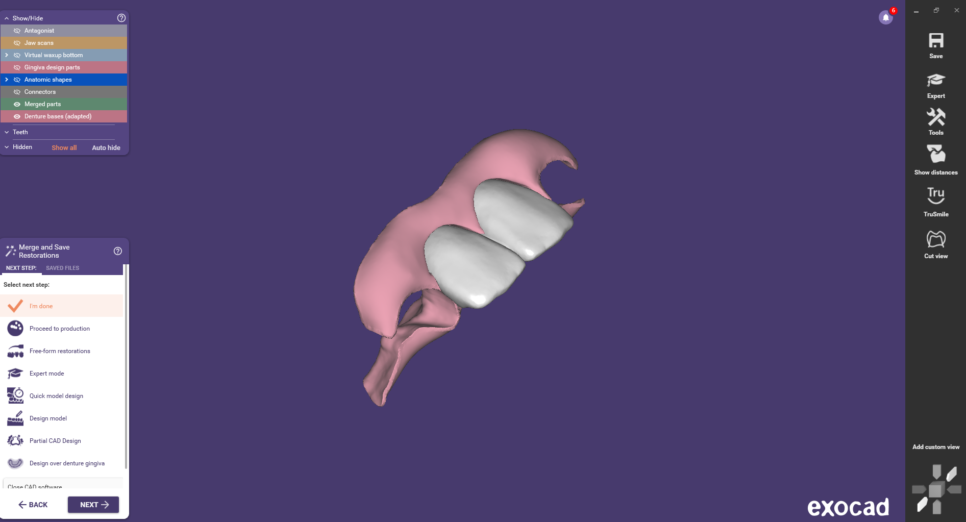 Workflow Guide: 3D Printing Flexible Dentures with HeyGears UltraCraft ...