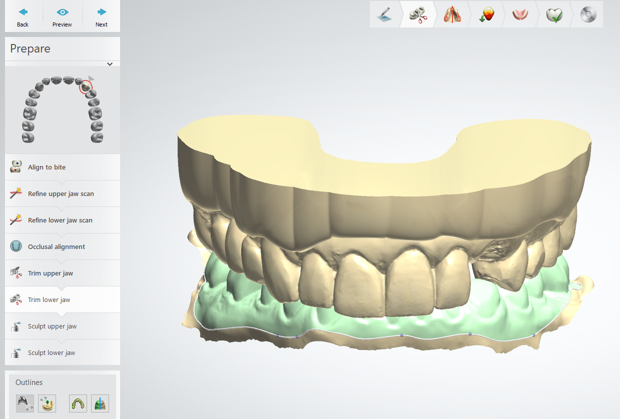 Workflow Guide: 3D Printing Flexible Dentures with HeyGears UltraCraft ...