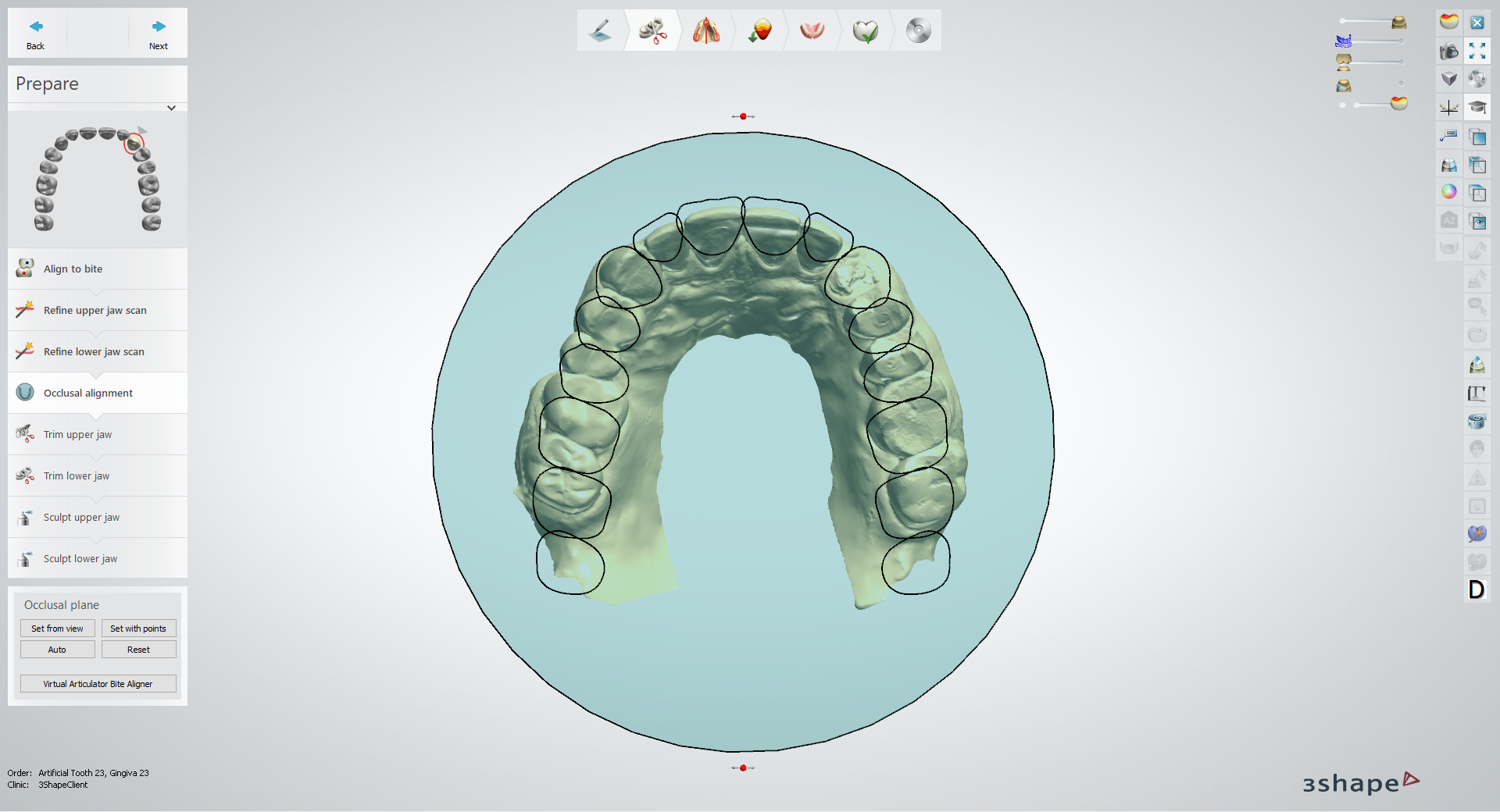 Workflow Guide: 3D Printing Flexible Dentures with HeyGears UltraCraft ...