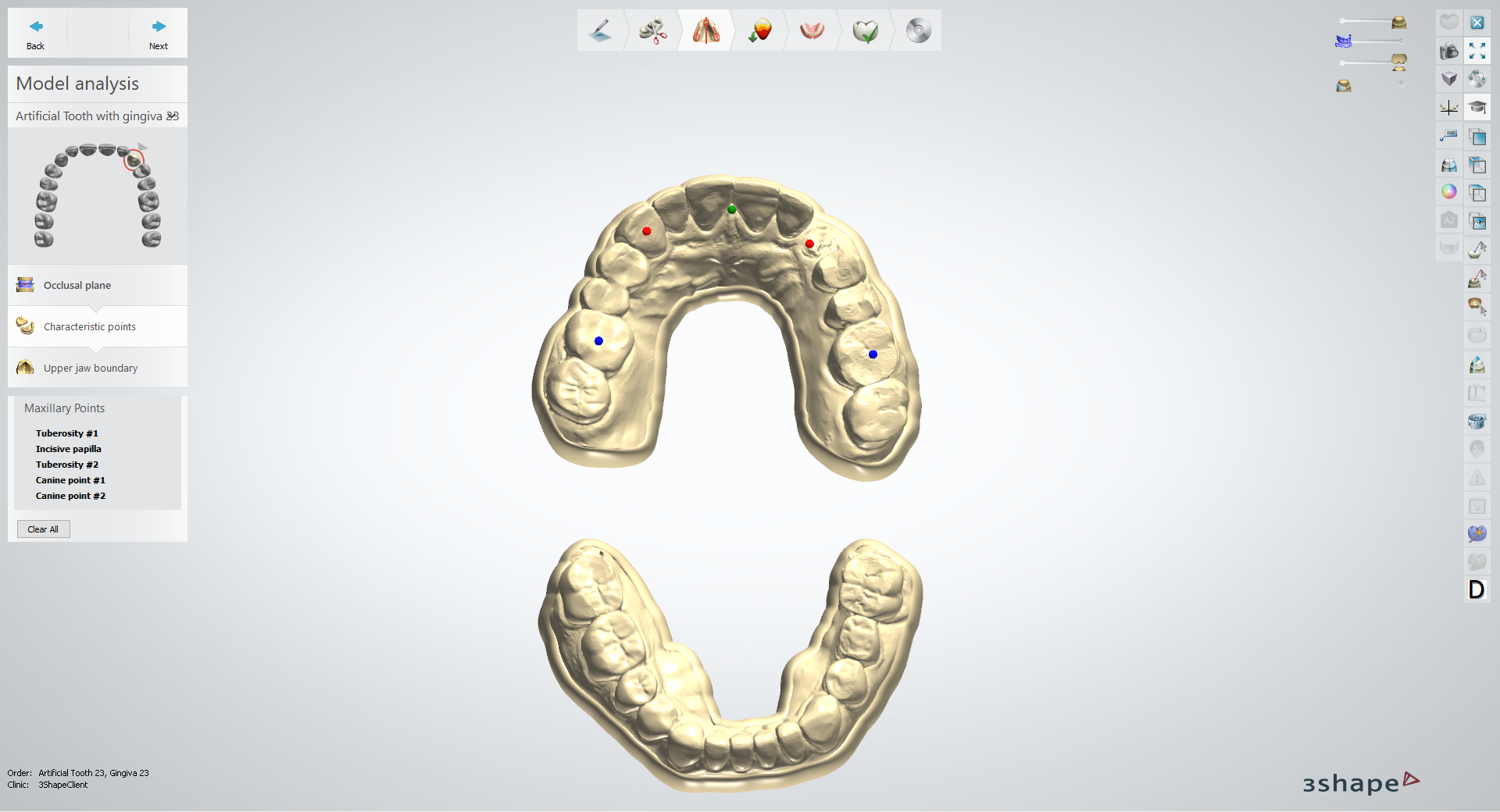Workflow Guide: 3D Printing Flexible Dentures with HeyGears UltraCraft ...