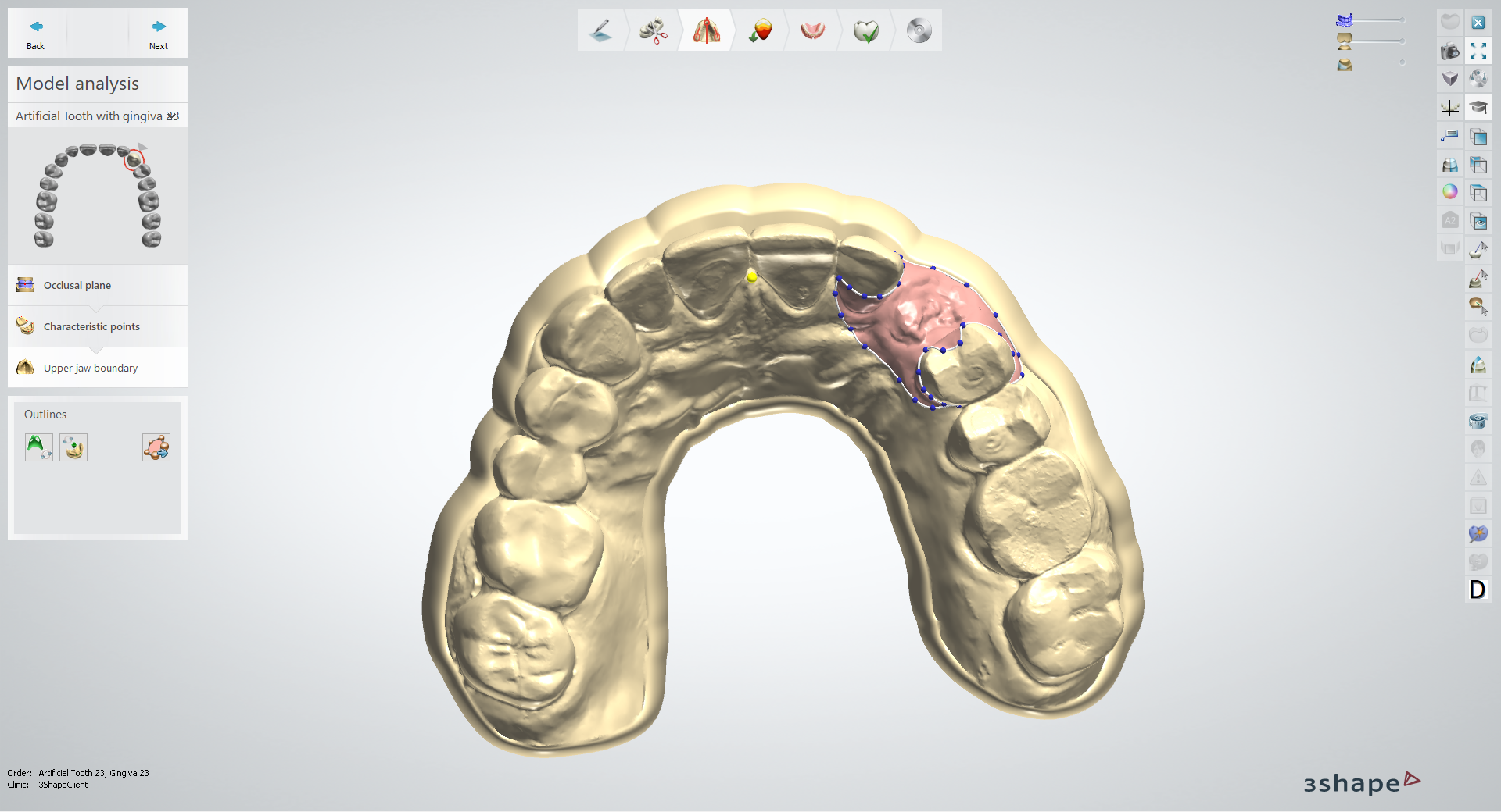Workflow Guide: 3D Printing Flexible Dentures with HeyGears UltraCraft ...
