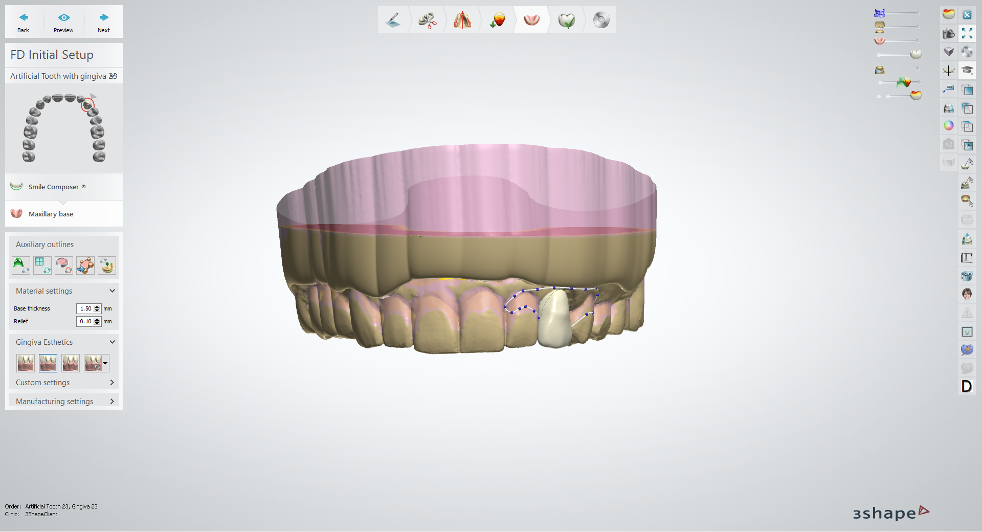 Workflow Guide: 3D Printing Flexible Dentures with HeyGears UltraCraft ...